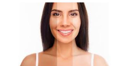 Skin Whitening Surgery – What it is all about? | Teecycle