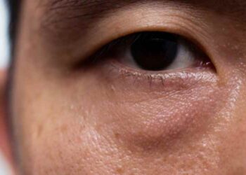 What is Gum Disease? Symptoms & Treatment Options | Teecycle